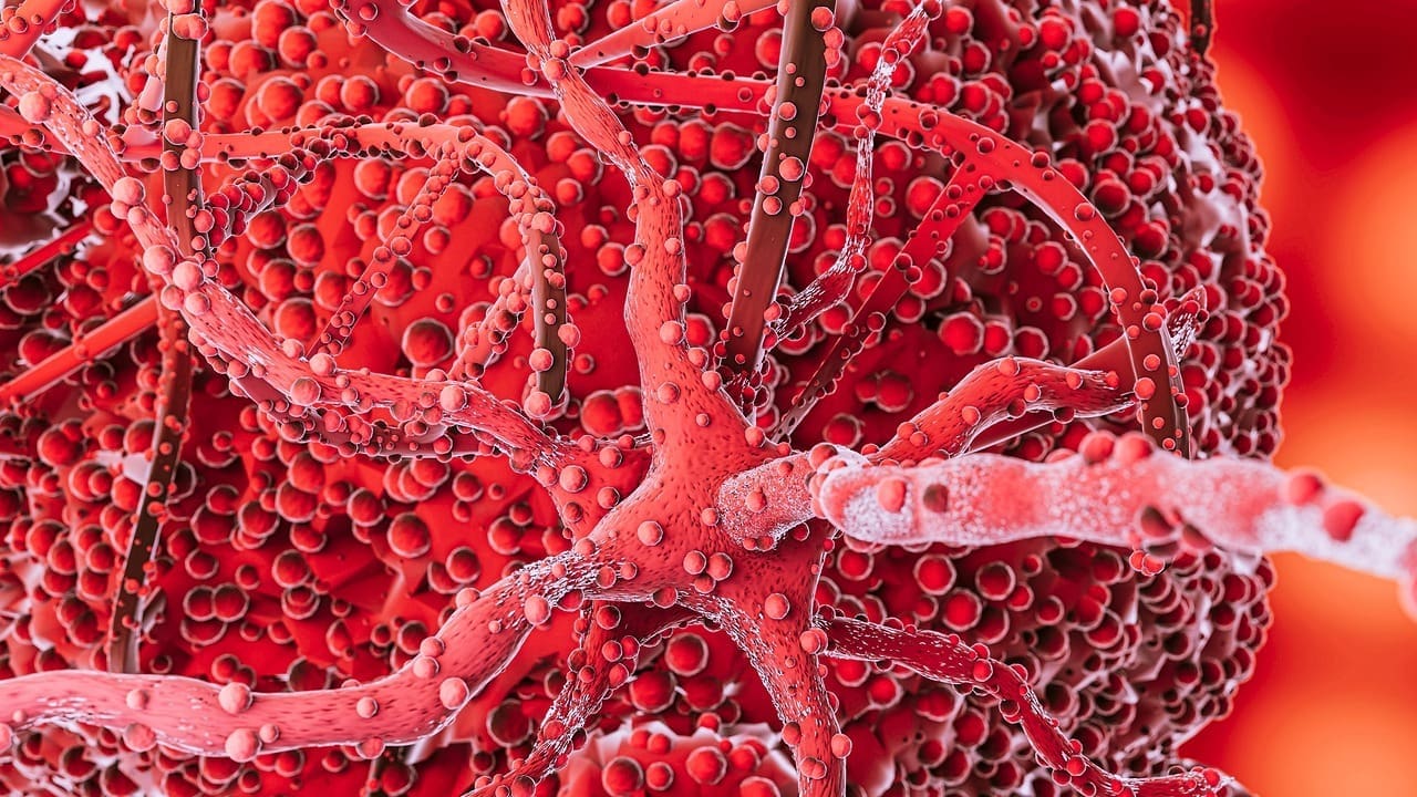 Diffuse Large B-Cell Lymphoma Treatment Options: 7 Key Approaches for Managing DLBCL and B-Cell Non-